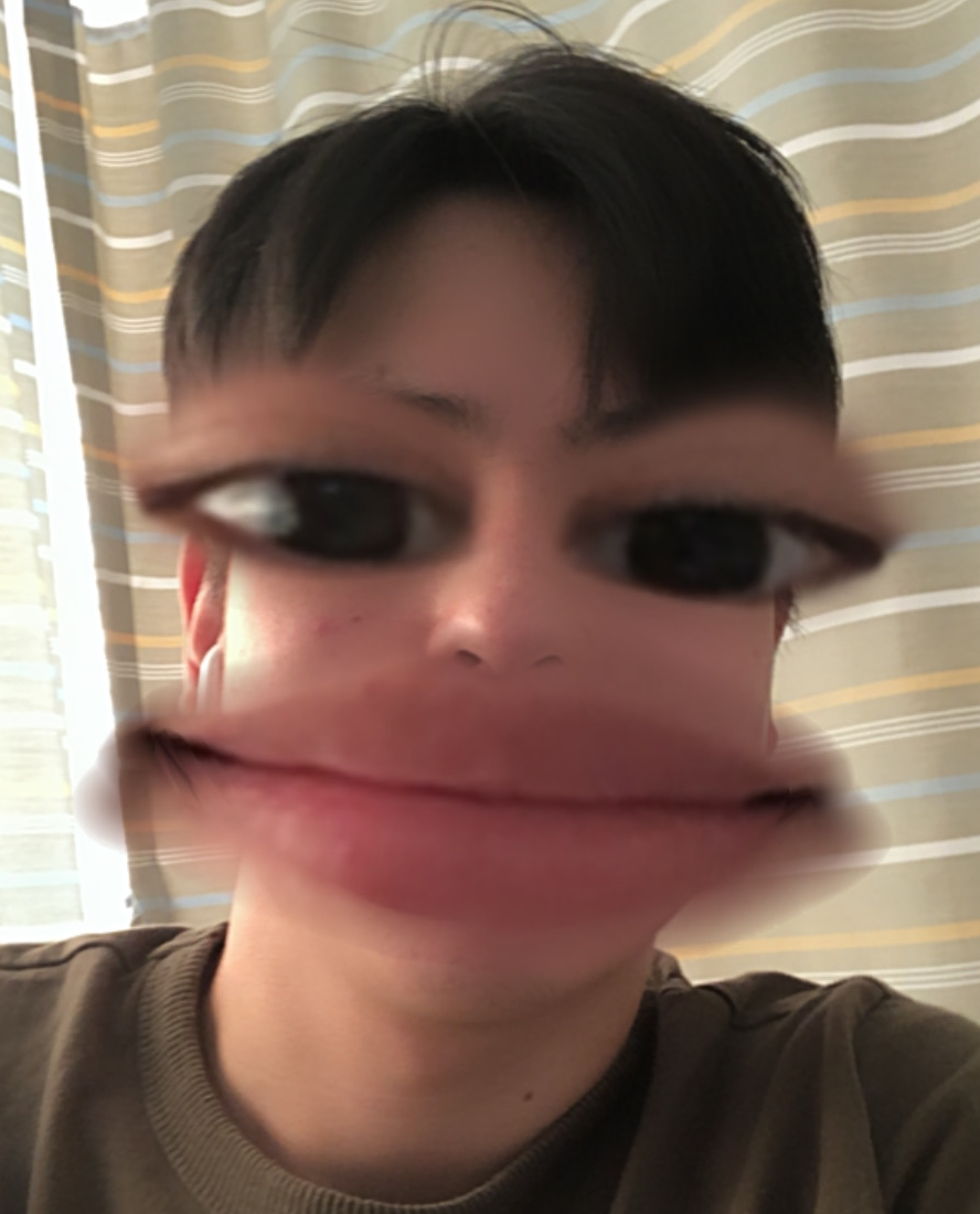 java.lang.ClassNotFoundException: javax.servlet.http.HttpServlet - MNIJ